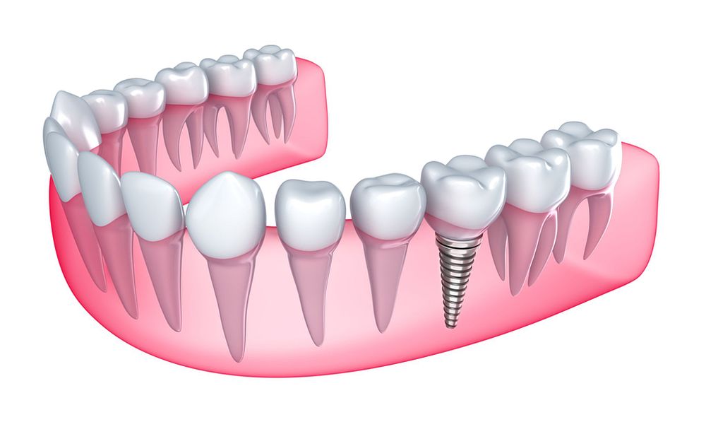 Salisbury Dental Offices | Dental Office Salisbury Maryland | Dr ...